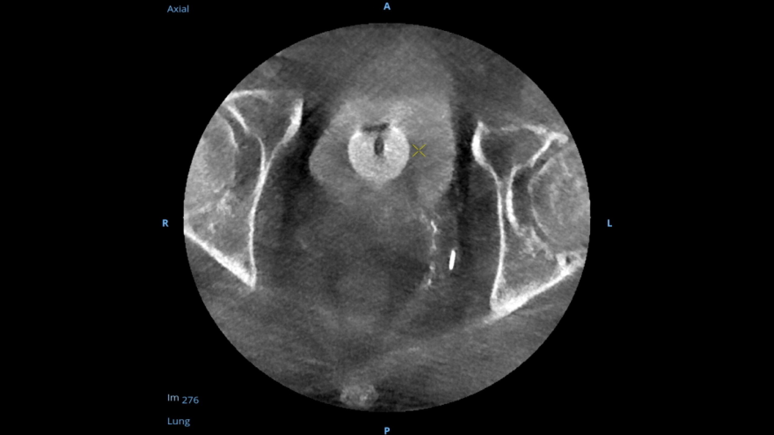 C arms for Interventional Radiology Imaging | GE HealthCare (United States)
