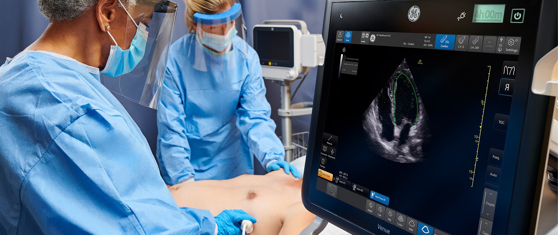 Venue Point of Care Ultrasound for MSK | GE Healthcare (United States)