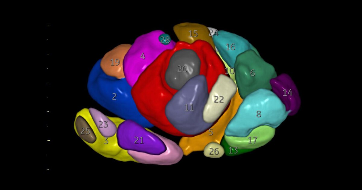 Fibroid Mapping | GE HealthCare (United States)