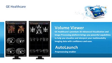 Volume Viewer | GE Healthcare (United States)