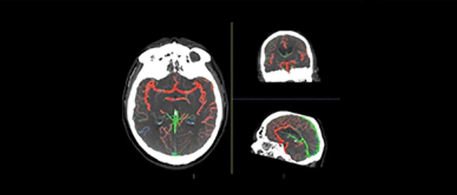 Advanced Visualization | GE HealthCare (United States)
