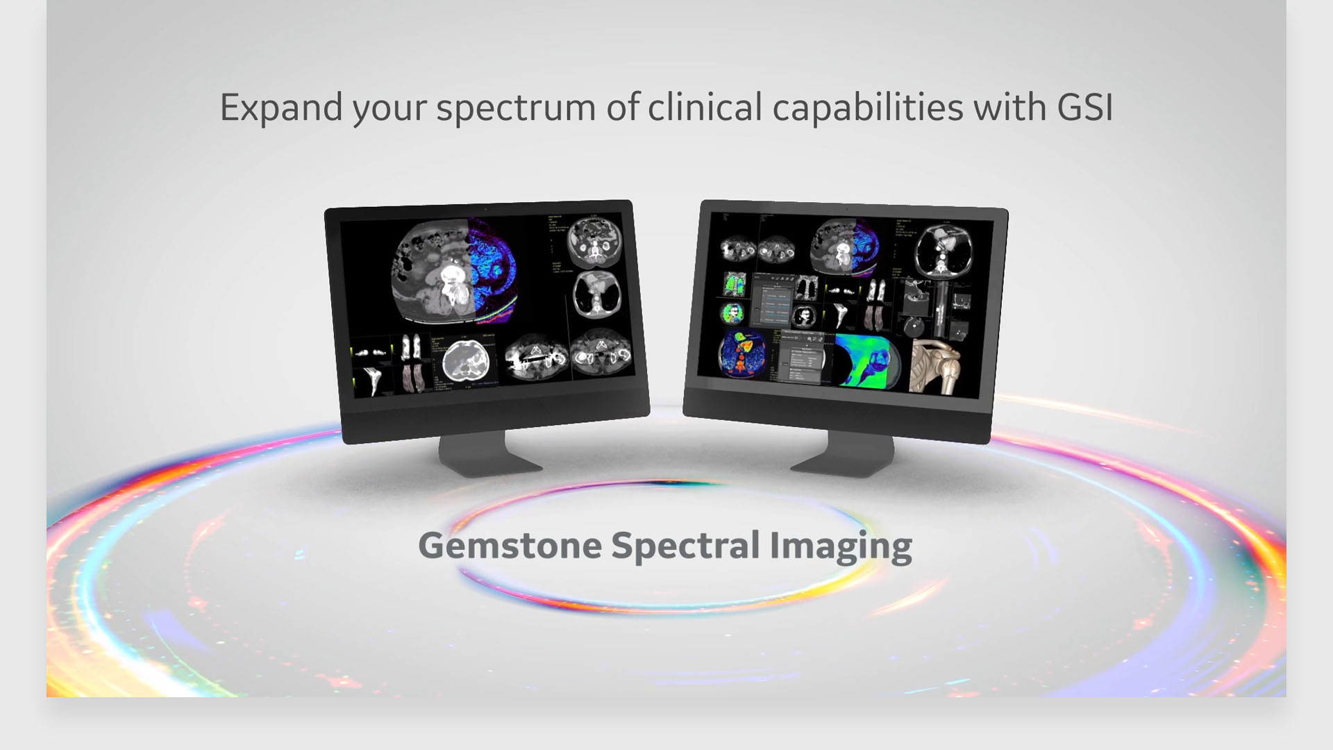 GSI Viewer AW Advanced Visualization | GE HealthCare (United States)
