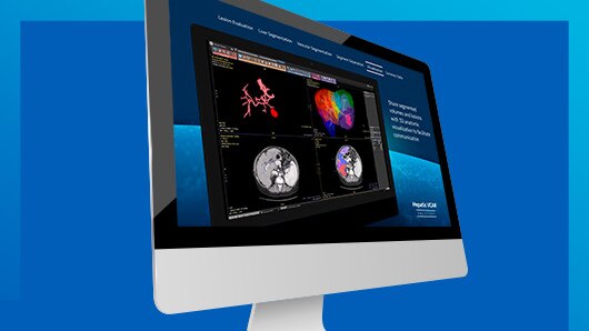 Hepatic VCAR | GE Healthcare (United States)