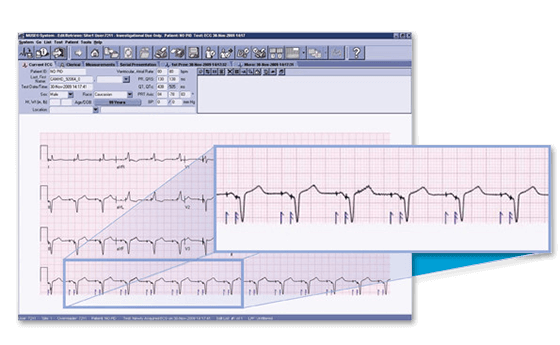 Diagnostic ECG | GE Healthcare (United States)