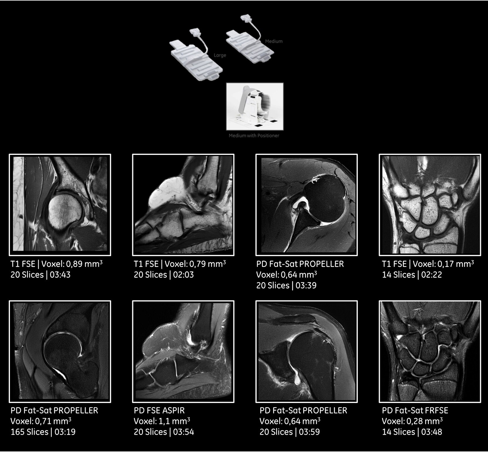 SIGNA™ Pioneer AIR™ Edition | GE HealthCare (United Kingdom)