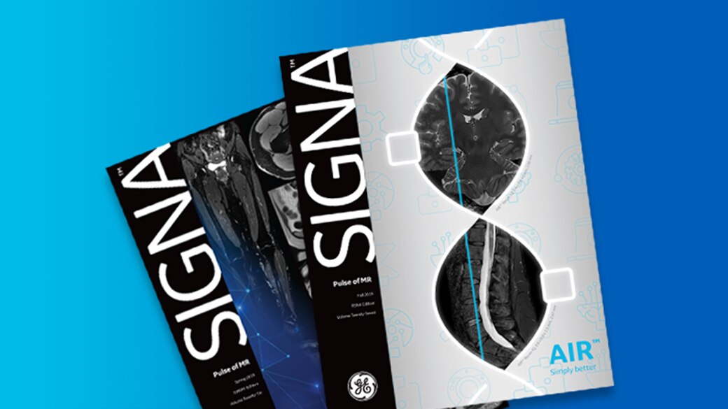 SIGNA™ Pulse of MR