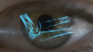 Radiography (X-ray) | GE HealthCare (United States)