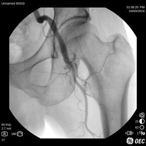 OEC One CFD | GE Healthcare (United States)