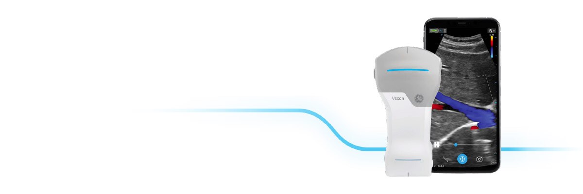 Vscan Handheld Ultrasound | GE Healthcare (United States)