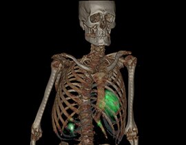 Volume Viewer | GE HealthCare (United States)