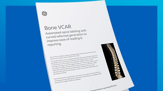 Bone Vcar Advanced Visualization for Computed Tomography | GE ...