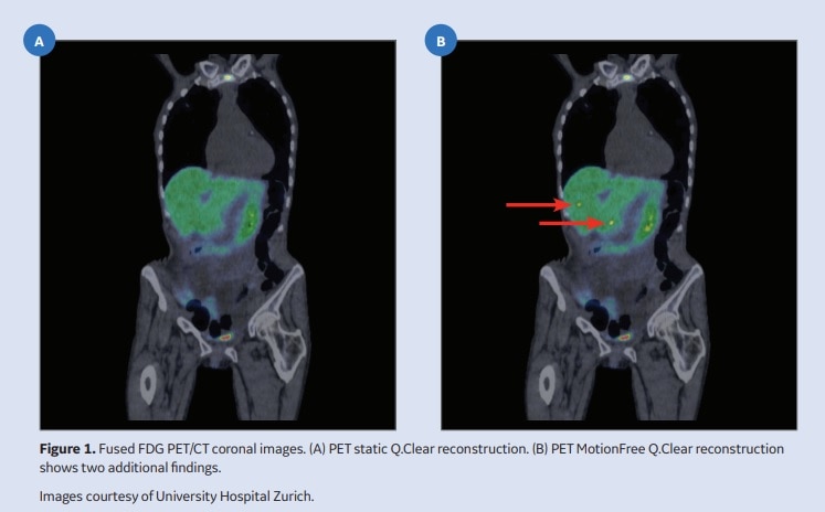 A Novel Approach to Seamlessly Integrating Respiratory Motion for all ... A Novel Approach to Seamlessly Integrating Respiratory Motion for all ...