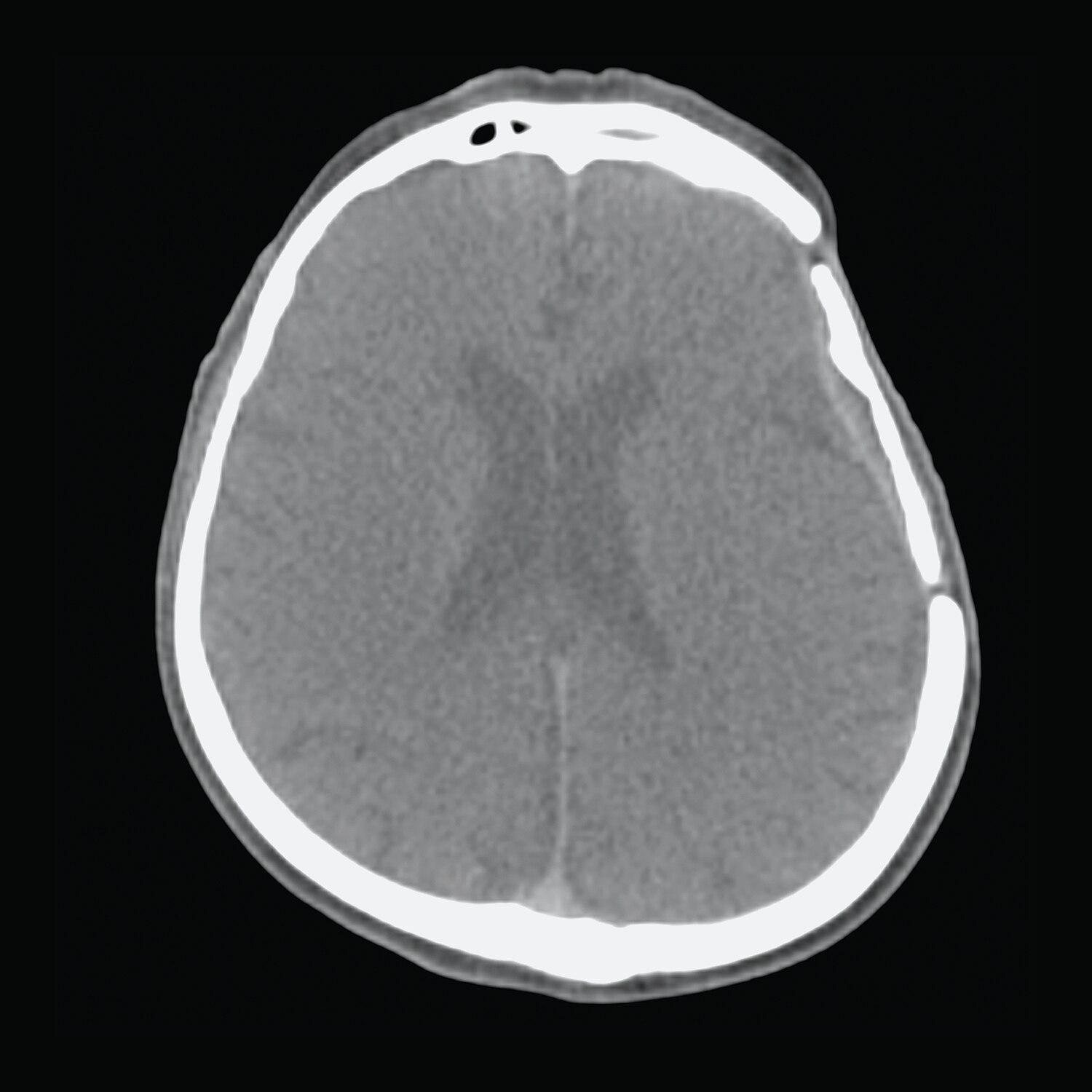 Diagnosis And Corresponding Gallium Scan