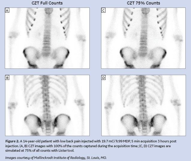 General Purpose CZT Detector Represents a New Era in Nuclear Medicine ...