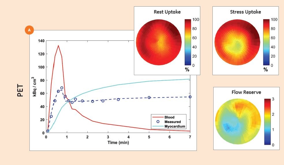 “With an 8-minute scan time, our motion artifacts are alsoless ...