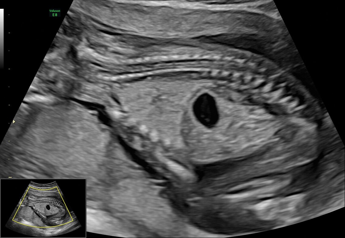 Voluson™ E8 | Women’s Health Ultrasound | GE Healthcare (United States)