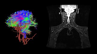 Hyperworks MRI Application for SIGNA™ | GE HealthCare (United States)