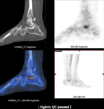 Clinical Image Library - Optima NM/CT 640 - GENERAL PURPOSE HYBRID ...