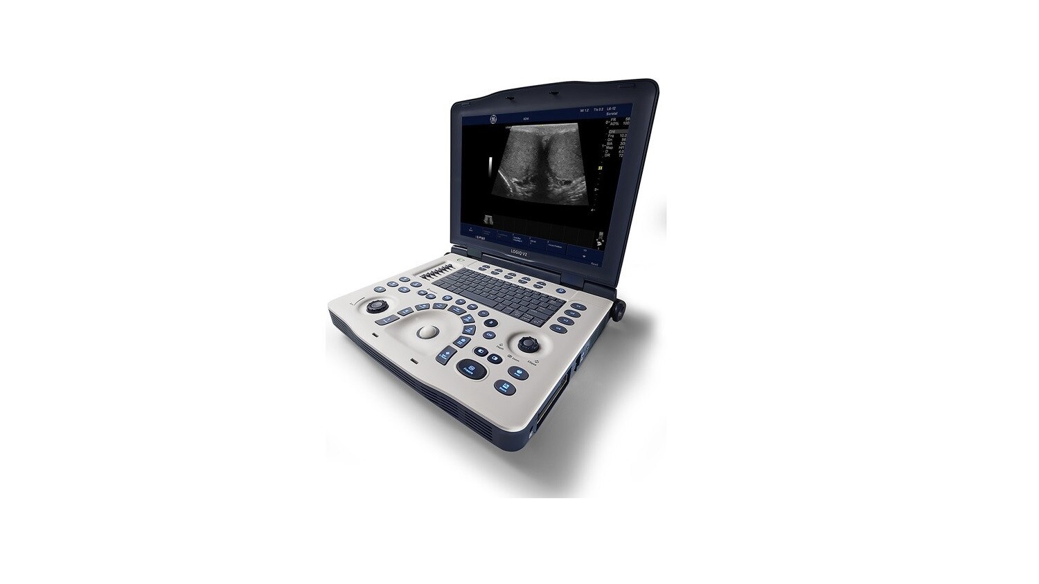 Logiq V2 Urology Ultrasound | GE HealthCare (United States)
