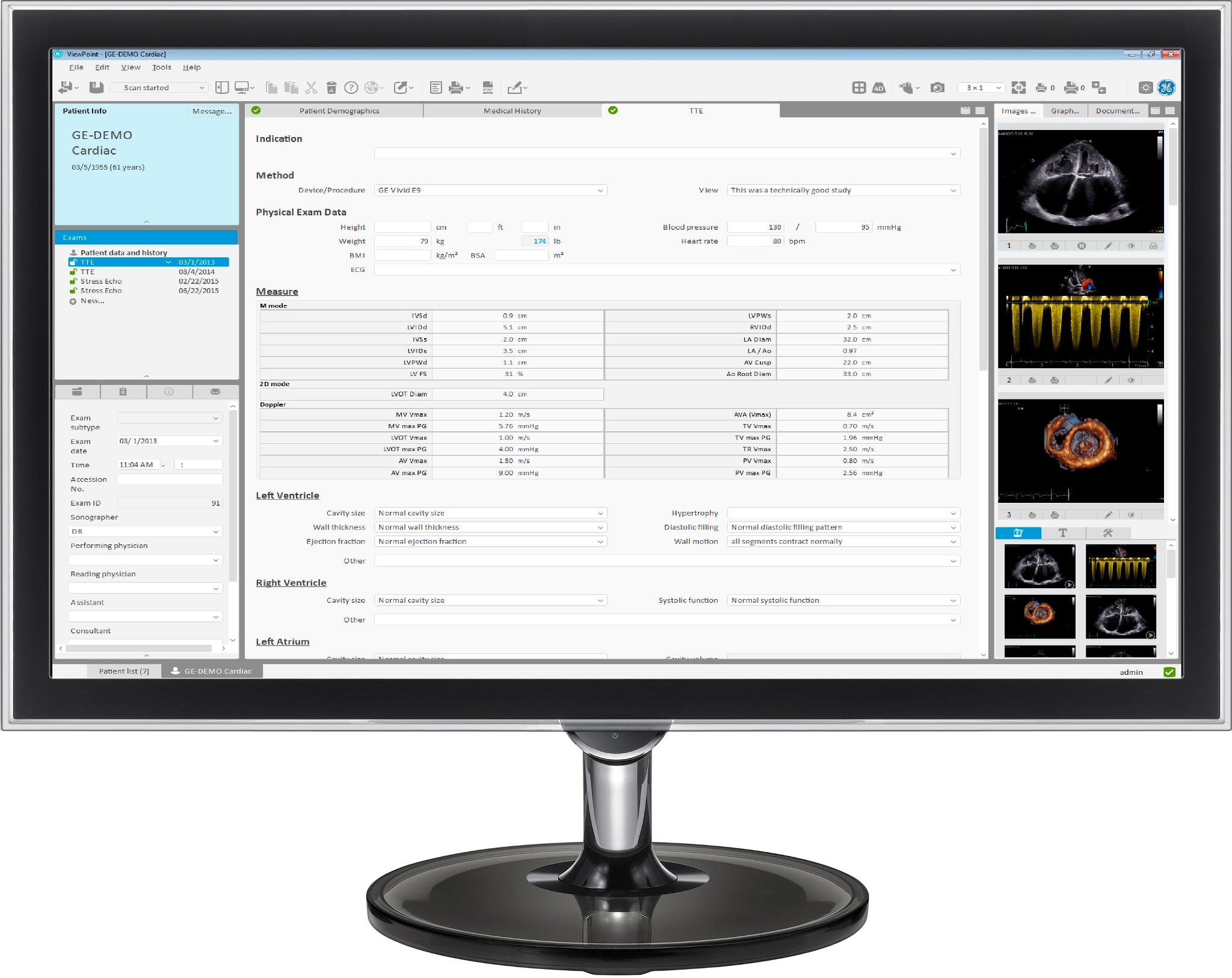 ViewPoint 6 and EchoPAC Suite for Cardiology | GE Healthcare (United ...