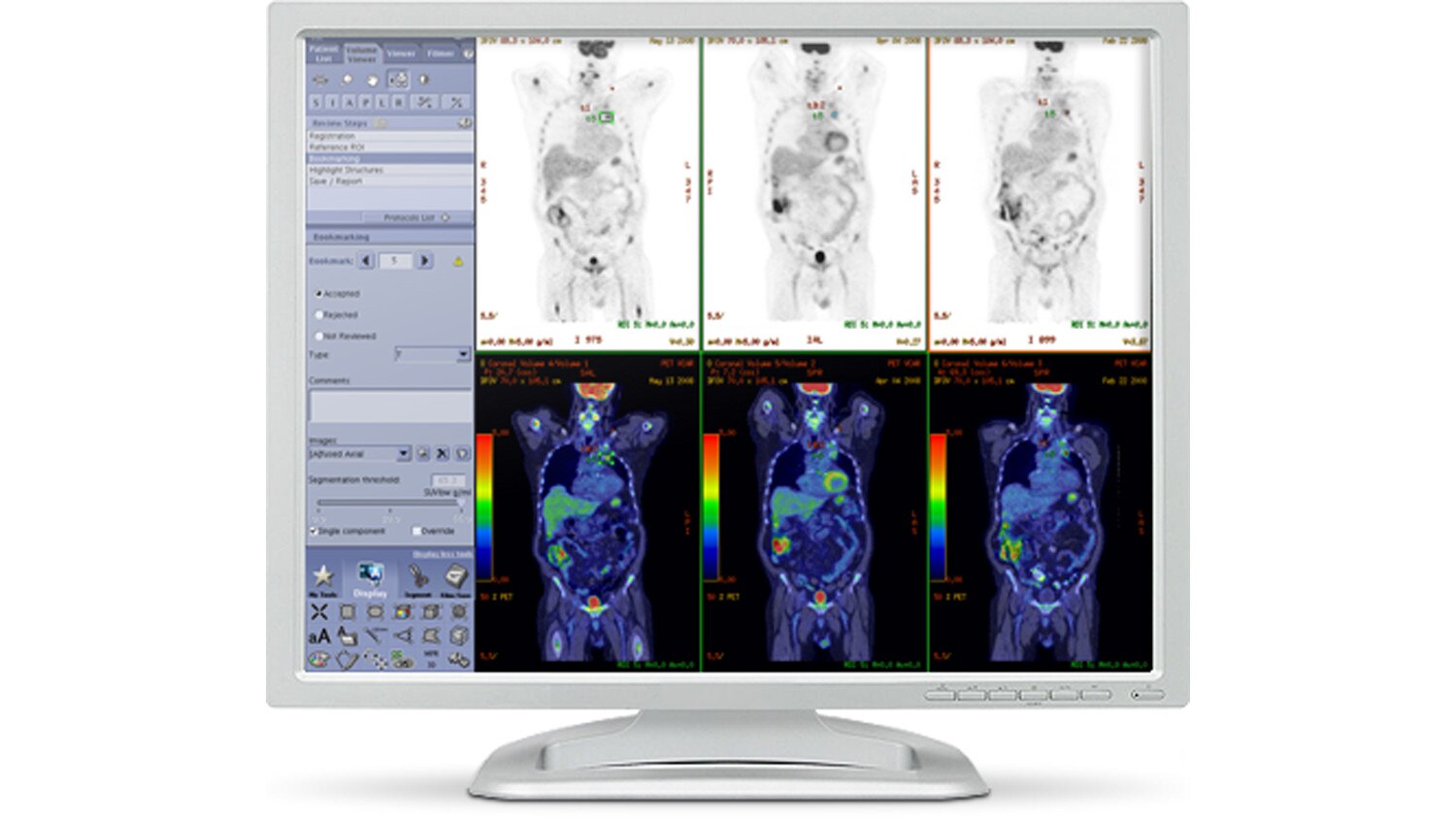 Course: AW PET VCAR Training | GE HealthCare (United States)