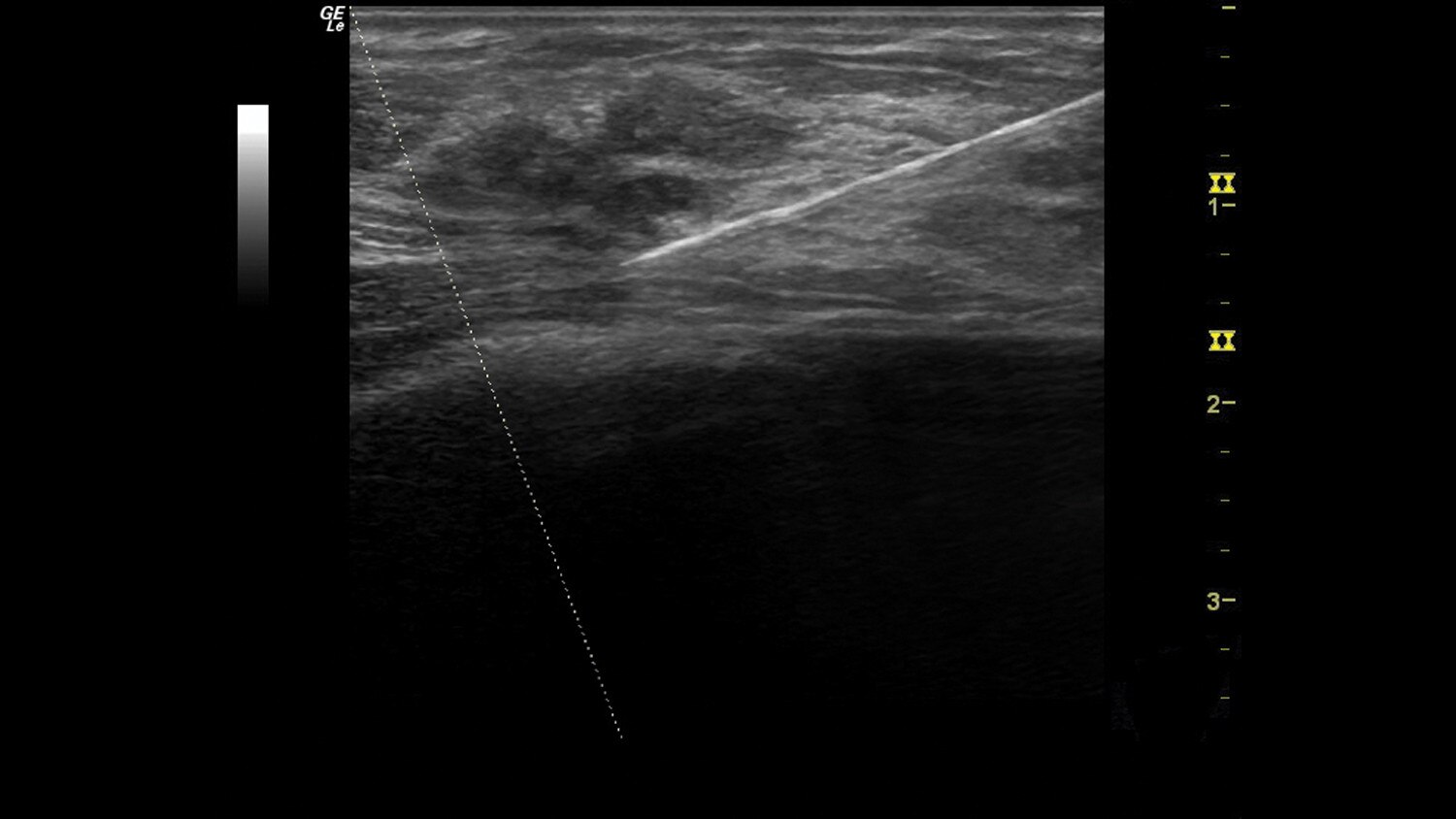 Course: Breast Surgery Training | GE HealthCare (United States)