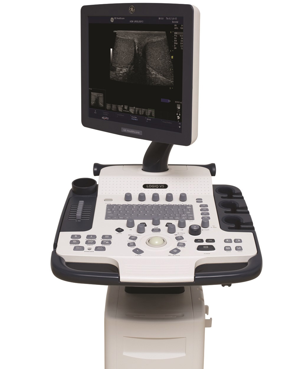LOGIQ V5 for Urology | GE Healthcare (United States)