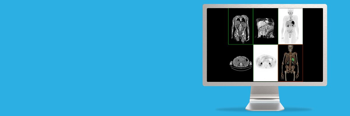 Volume Viewer | GE Healthcare (United States)