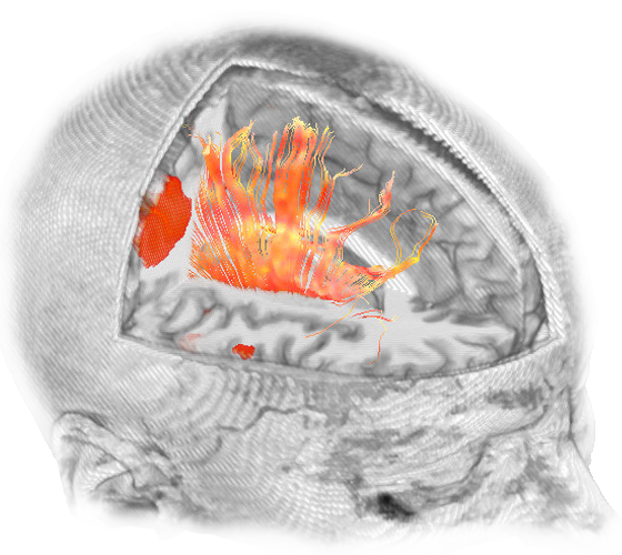 BrainWave | GE HealthCare (United States)