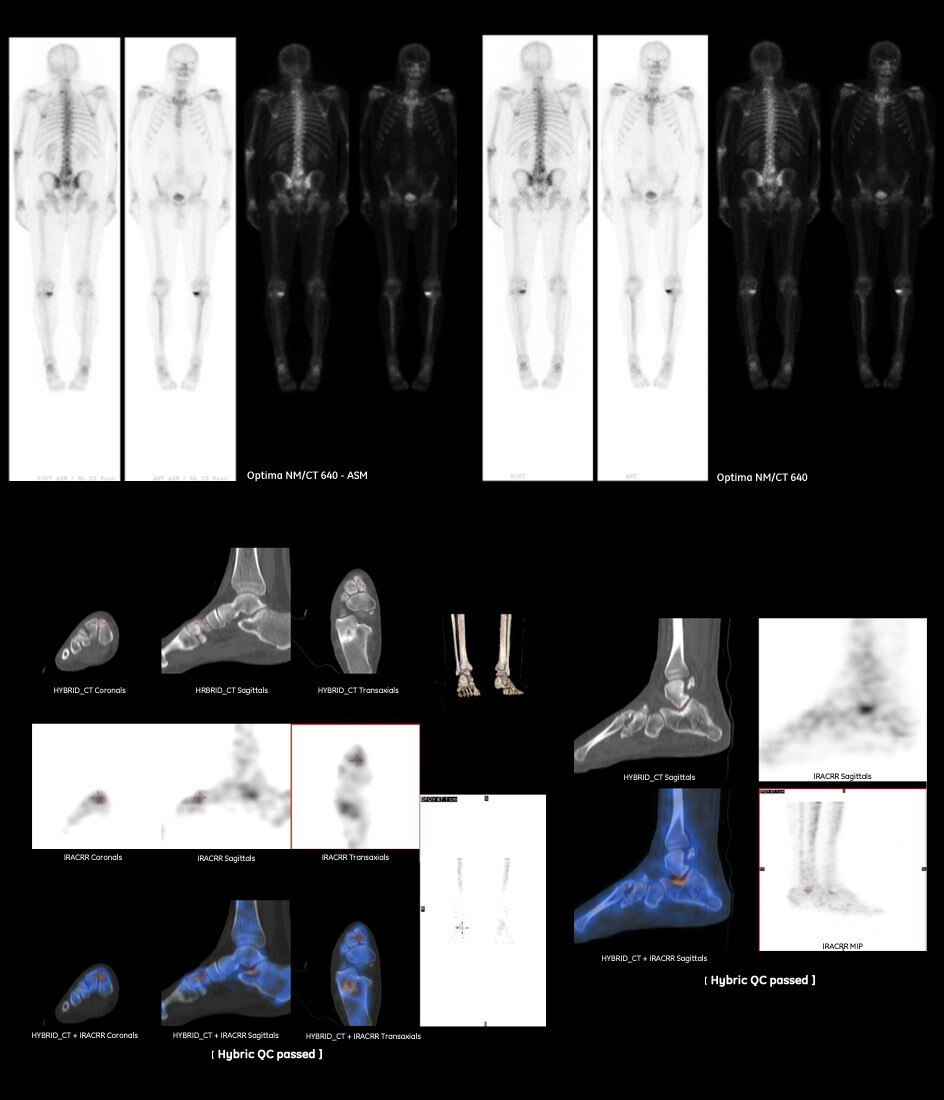 Clinical Image Library - Optima NM/CT 640 - GENERAL PURPOSE HYBRID ...