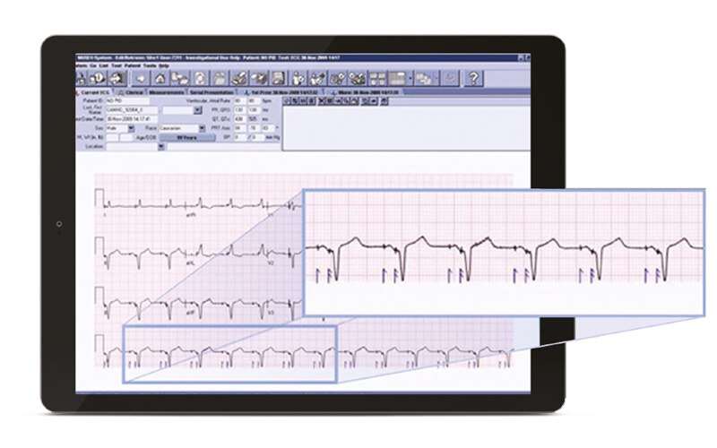 Cardiology Solutions - Heart Failure | GE Healthcare