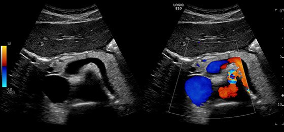 LOGIQ™ E10 Ultrasound | GE Healthcare