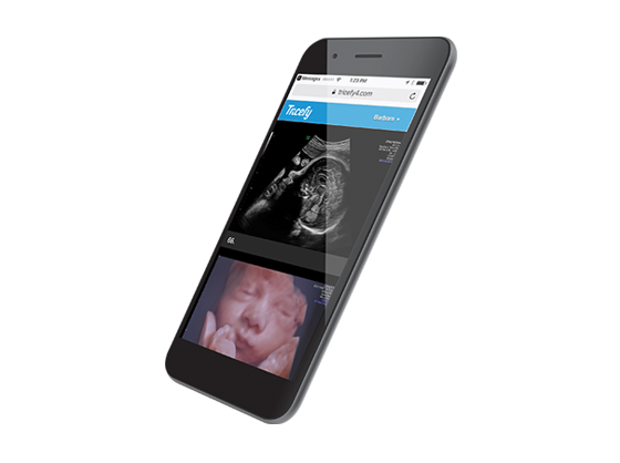 2D, 3D and 4D Ultrasound | Voluson S8 | Voluson Signature Series | GE ...