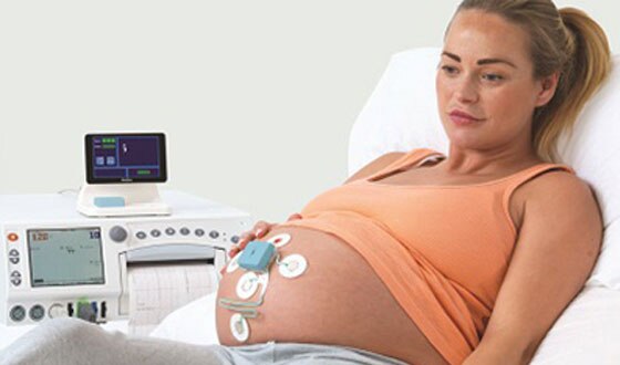 Monica Novii Wireless Patch System | GE Healthcare