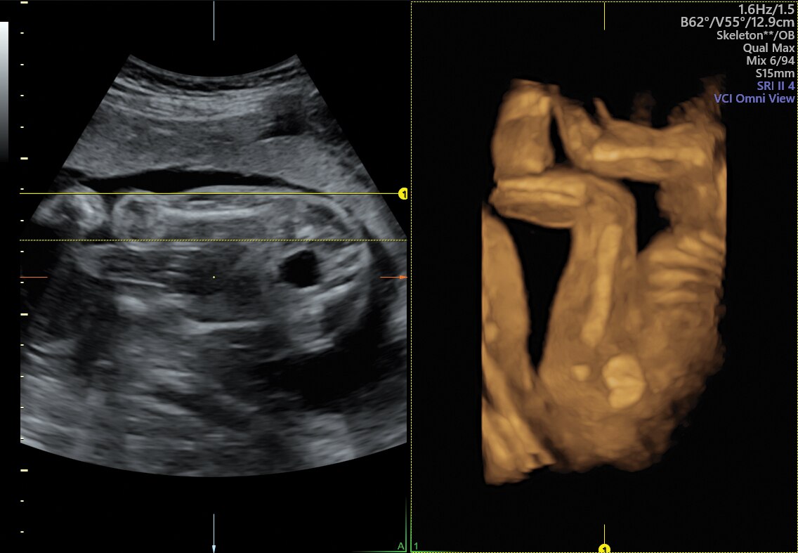 Voluson E8 | GE Healthcare