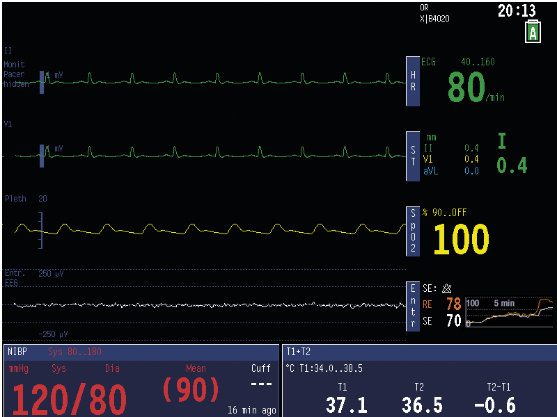 B40 Patient Monitor | GE Healthcare