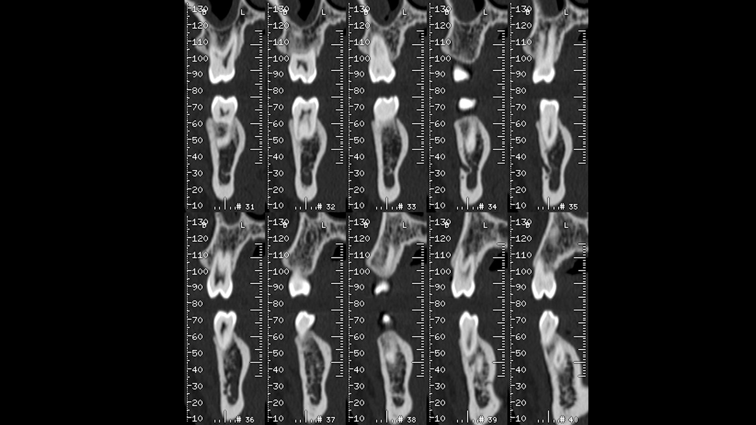 DentaScan | GE Healthcare