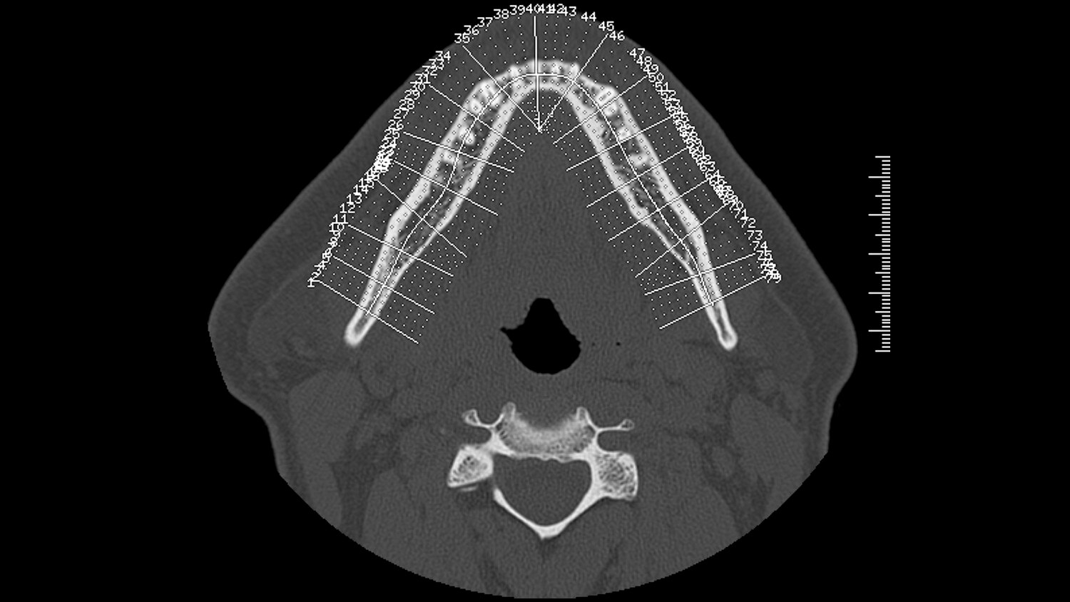 DentaScan | GE Healthcare