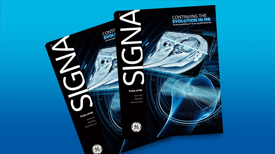 Upgrade to MR 30 for SIGNA™ MRI scanners | GE Healthcare (United States)