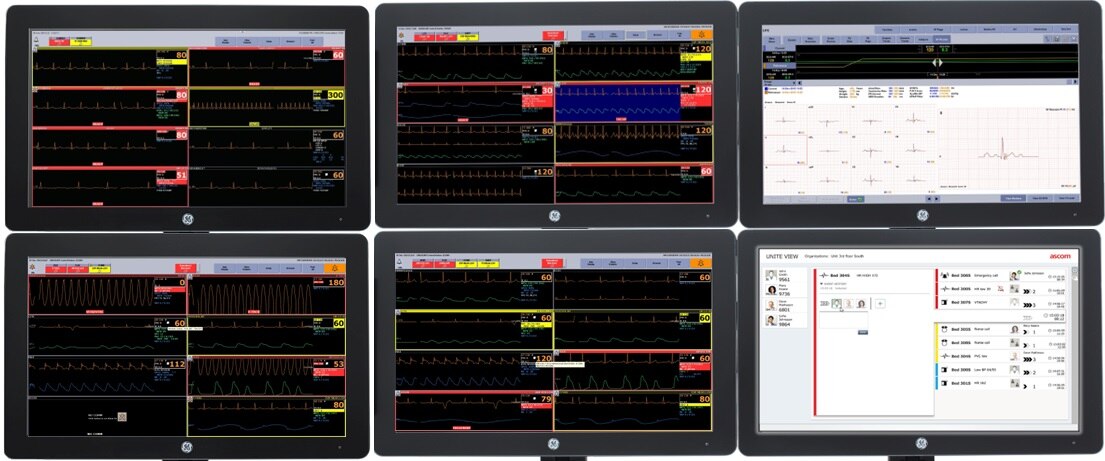 Digital CMU | GE HealthCare (United States)