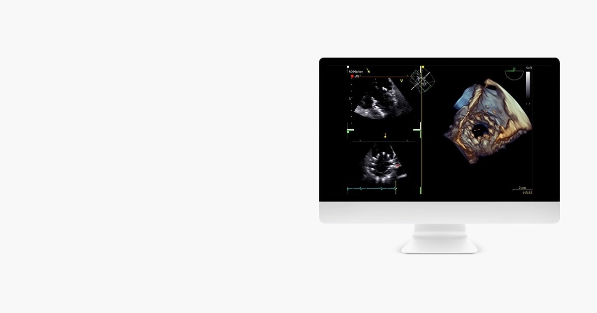 Vivid Cardiovascular Ultrasound Systems | GE HealthCare (United States)