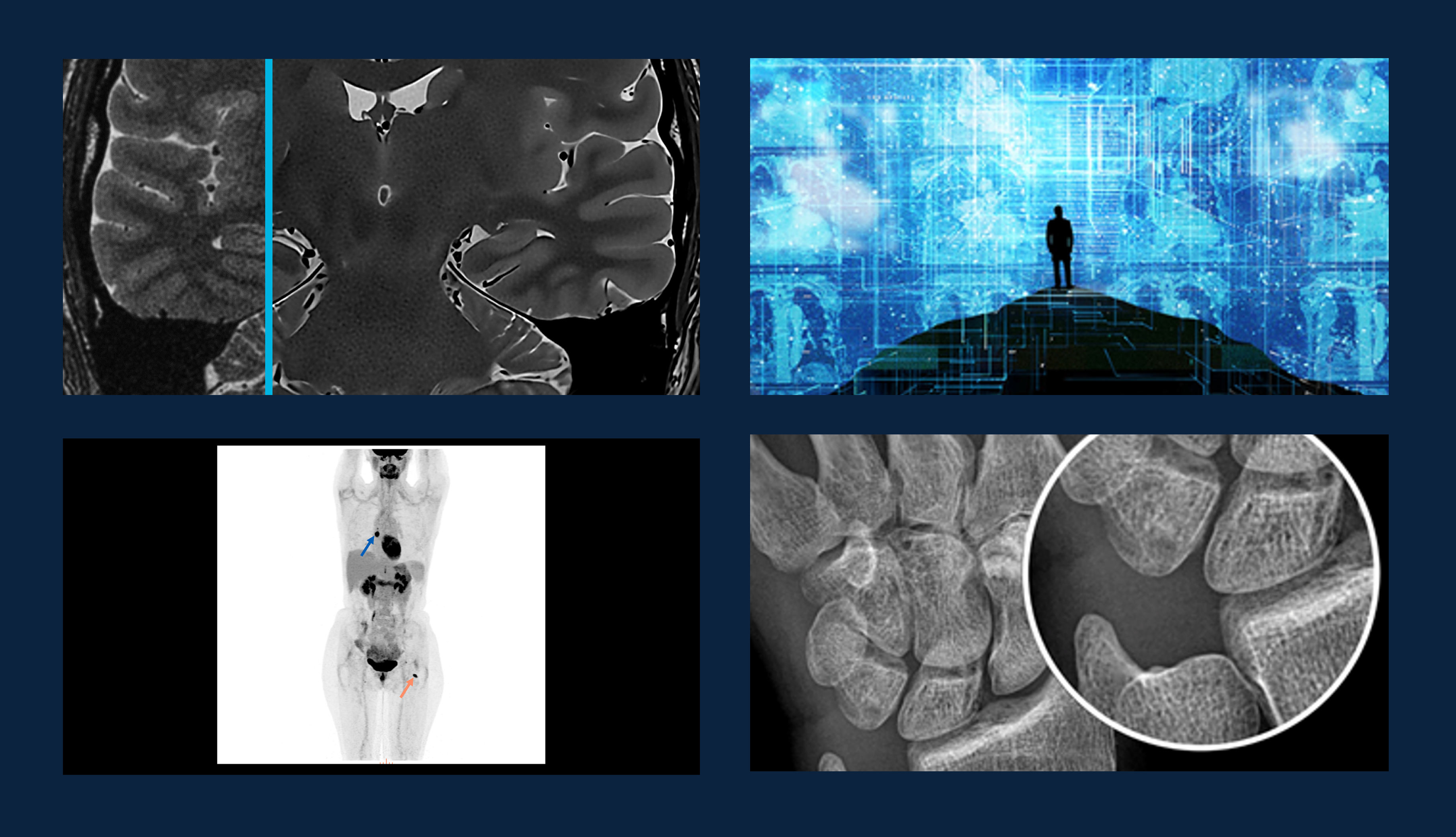 Deep learning image reconstruction: Improving IQ and patient outcomes ...