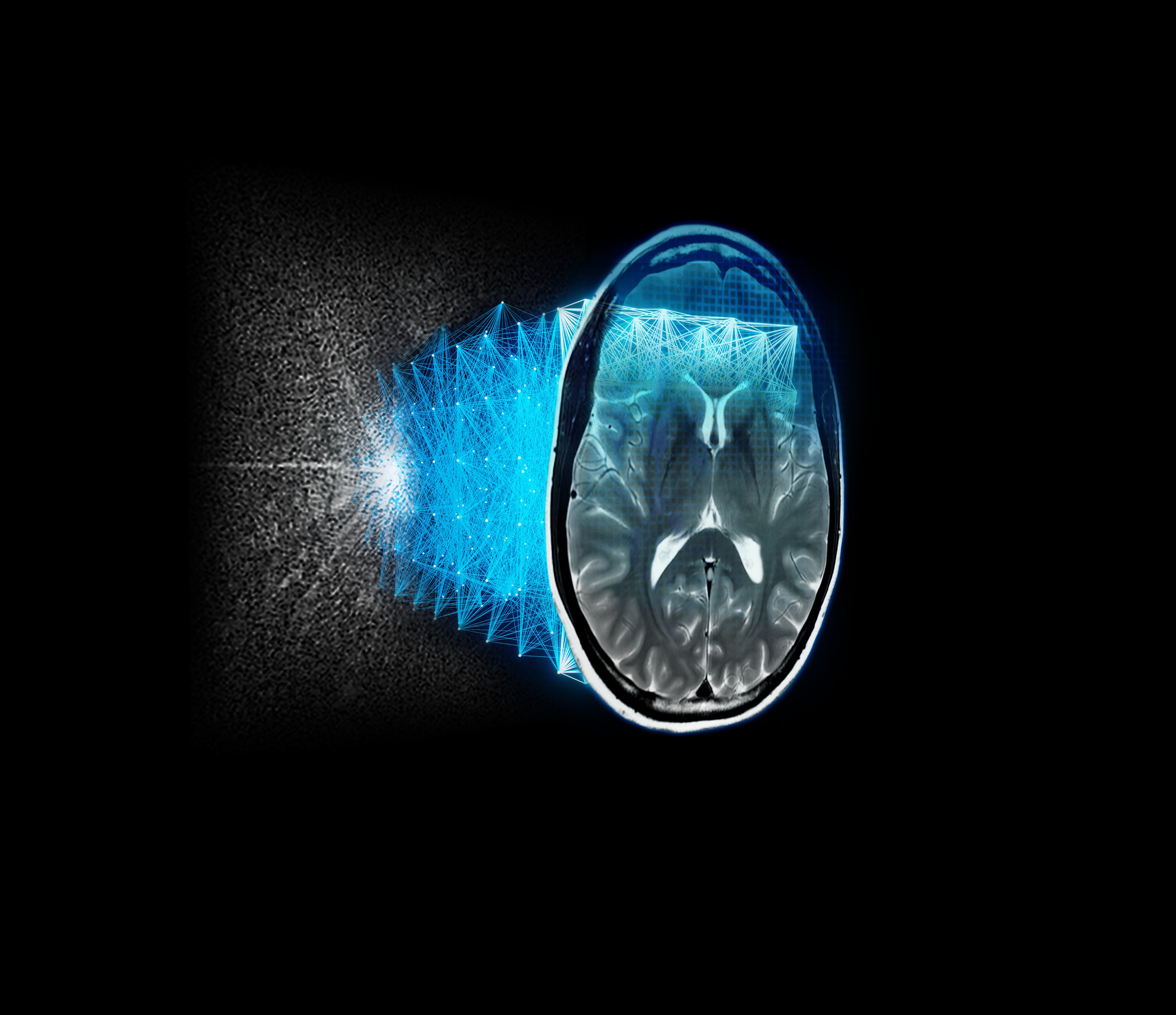 Intelligently Efficient with Deep-Learning Reconstruction in MRI