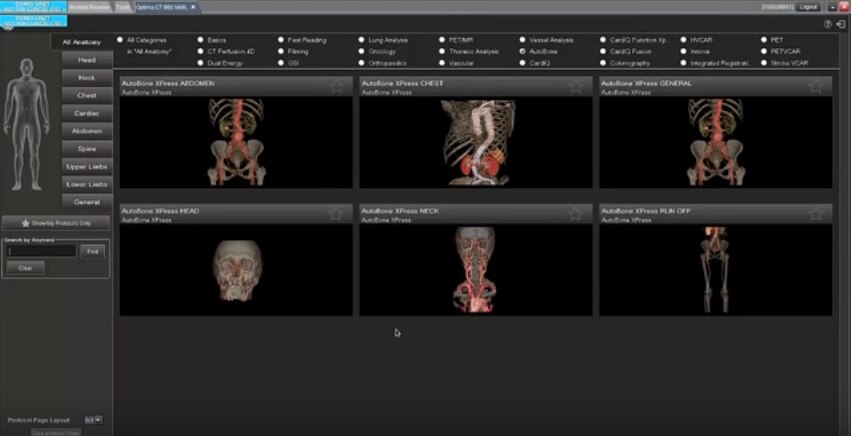 Advanced Visualization | GE Healthcare (Malaysia)