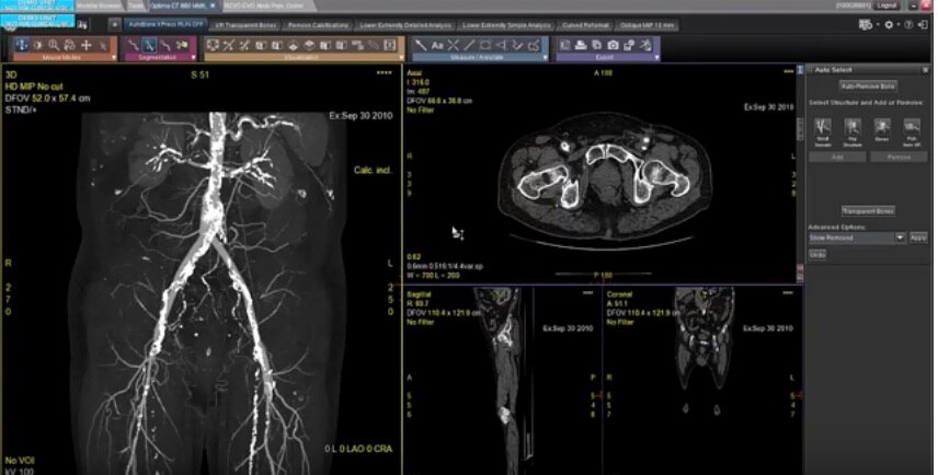 Advanced Visualization | GE Healthcare (Malaysia)