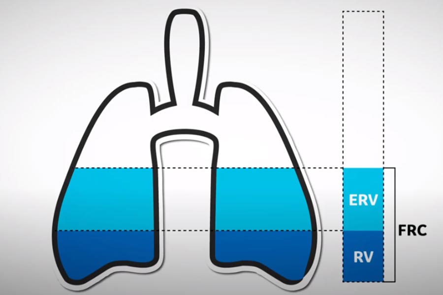 Lung Protective Ventilation Ards Patients | GE Healthcare (Malaysia)
