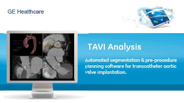 TAVI Analysis | GE Healthcare (Malaysia)