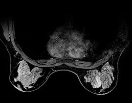 Breast Imaging | GE Healthcare (Malaysia)
