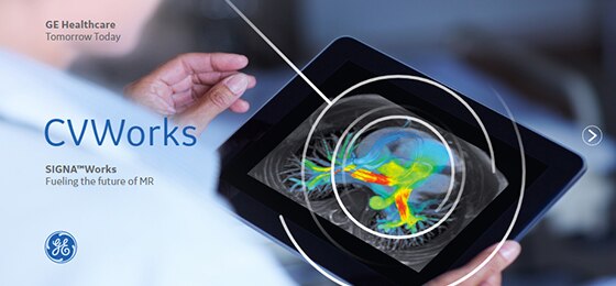 SIGNA Works | GE Healthcare (Malaysia)