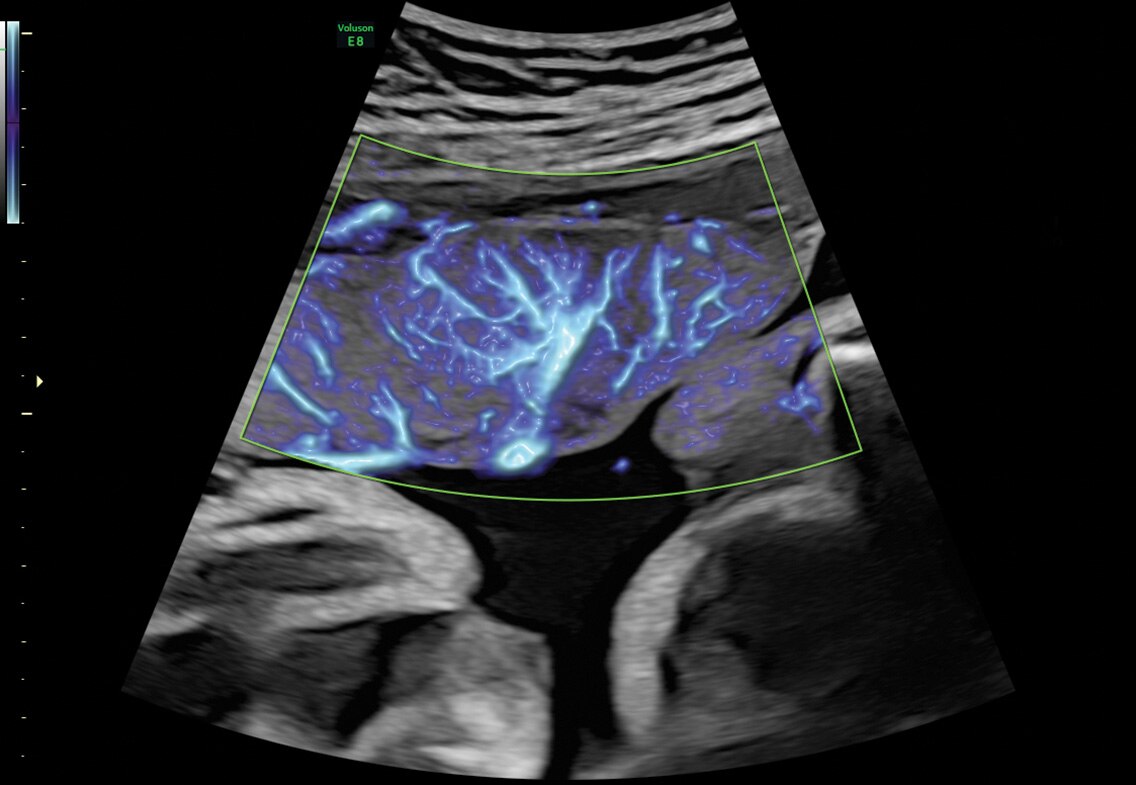 Voluson E8 | GE Healthcare (Malaysia)